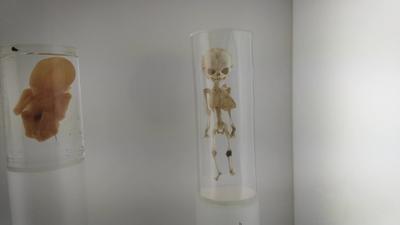 Preserved Medical Specimen Of Human Fetus 5912 B - Free HD Video Clips ...